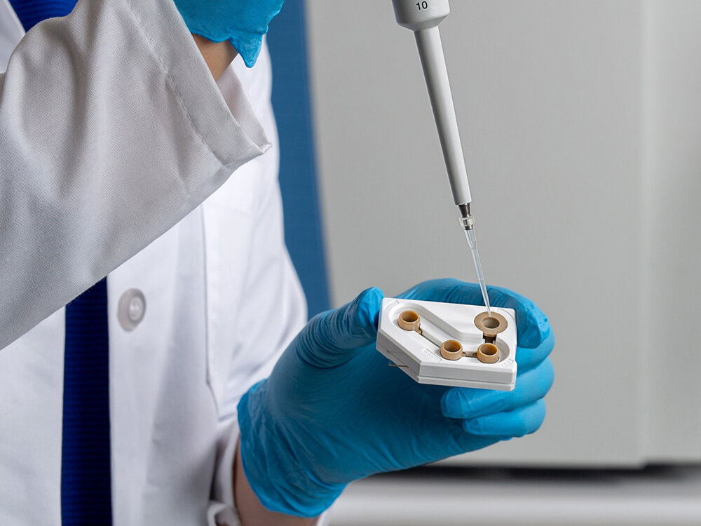 PATsmart™ ZipChip® Microfluidic CE-MS Interface